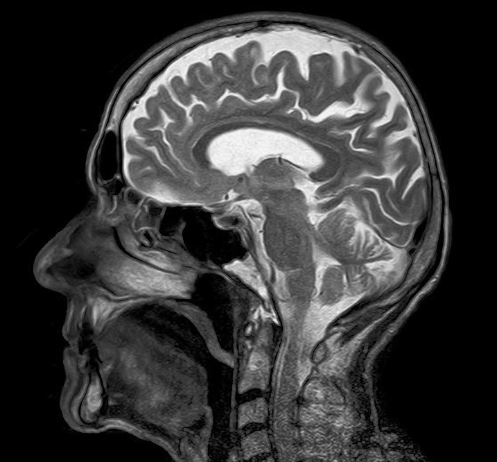 MIT’s Shocking Findings from First Brain-Scan Study of ChatGPT Users ...