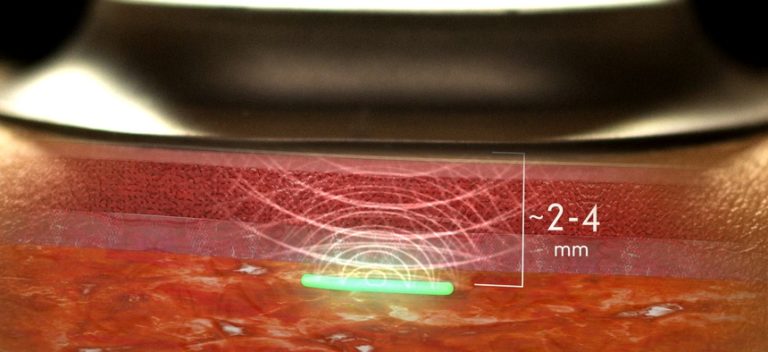 Hydrogel Biosensor: Implantable Nanotech? | Principia Scientific, Intl.